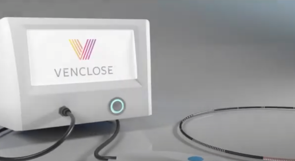 Varicose Veins – Miami Vascular Center